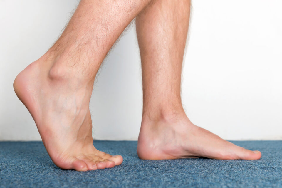 Stump Neuroma: How To Get Back On Your Feet?
